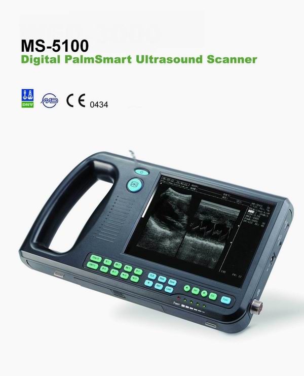 MS-5100 Digital Palm Ultrasound Scanner - Buy Ultrasound Scanner ...